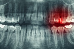 Information & Resources – Barranca Dental Excellence
